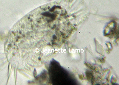 Microscopy Pond Water Critters | Microbus Microscope Educational Website
