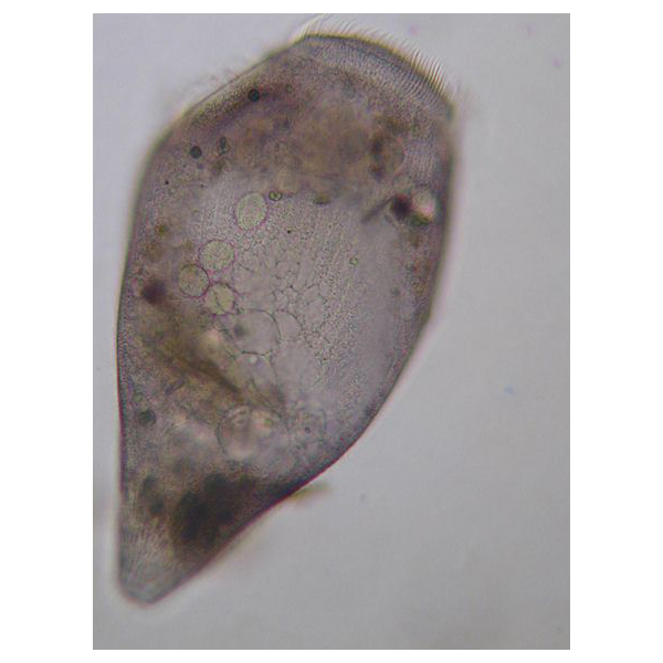 Euplotes Under Microscope