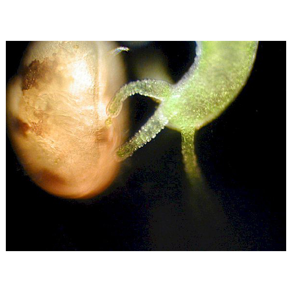Euplotes Under Microscope