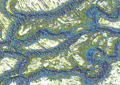 Coins | Microbus Microscope Educational Website